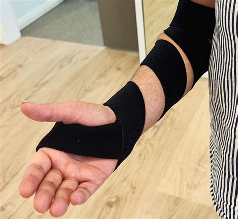 Custom Thermoplastic Splints Hand Therapy Clinic Sydney