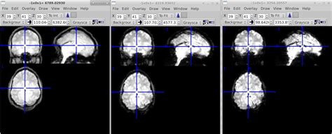 Preprocessing Multi Echo Fmri Data By Fmriprep Amd Tedana Tedana Neurostars