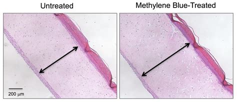 Methylene Blue Shows Potential As Anti Aging Treatment Cell And