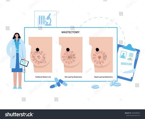 Types Female Mastectomy Surgery Remove Cancerous Stock Vector Royalty