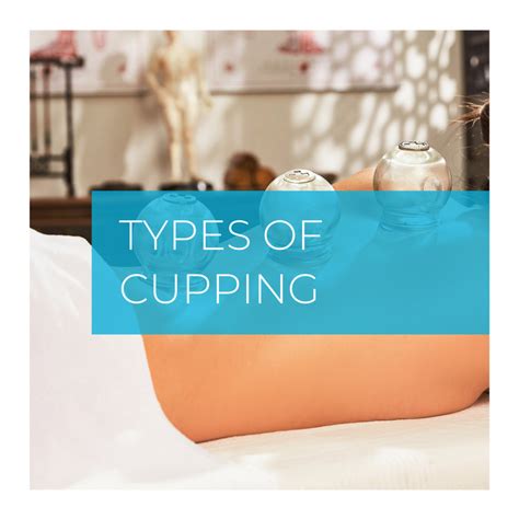 Cupping Therapy In Short