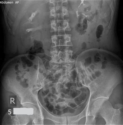 10 Parenchima Renale Foto Stock Immagini E Fotografie Royalty Free