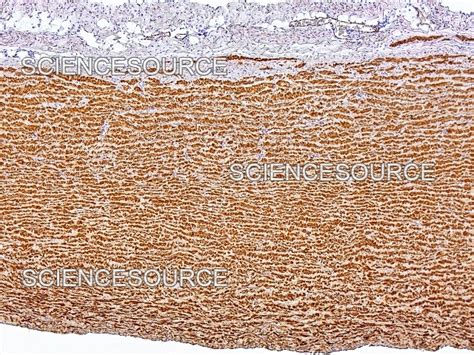 Aorta Light Micrograph Stock Image Science Source Images