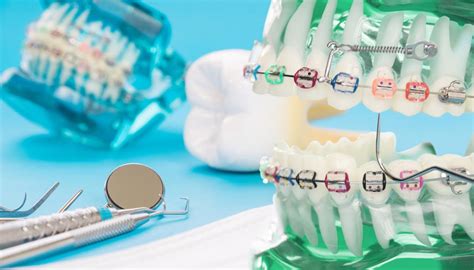 O Uso De Elastômeros Na Odontologia Compostos