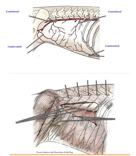 Epigastric Artery