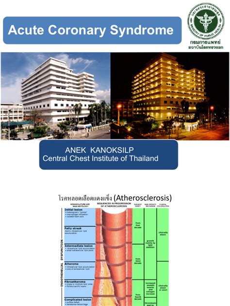 Guideline Acs Ho Pdf