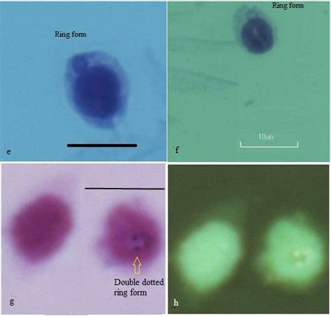 Uninfected And Infected Shrimp Hemocytes × 100 May Grunwald Giemsa