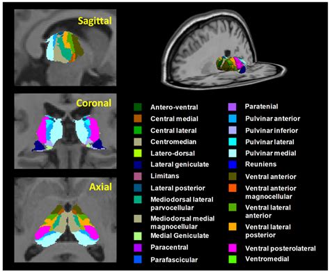 Three Dimensional Atlas Of The Thalamic Subnuclei Segmentation Download Scientific Diagram