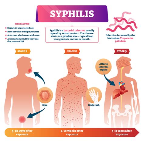 Testing For Syphillis Community Care Resources Of Florida Testing For Syphillis Community Care Resources Of Florida