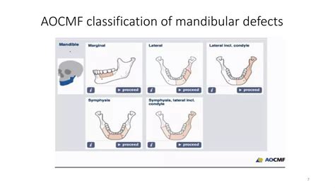 Classification Of Mandibular Defects Pdf