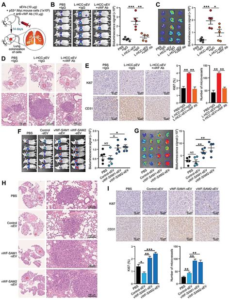 Sev Vwf Promotes Hcc Metastasis A Schematic Diagram Of The