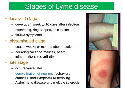 Ppt Lecture 16 Bio3124 Powerpoint Presentation Free Download Id 4025744
