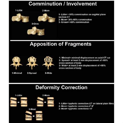 Mccormack Classification Download Scientific Diagram