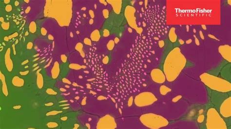 Edx Analysis With Sem How Does It Work Accelerating Microscopy