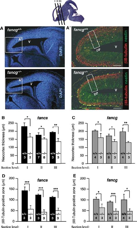 Fa Embryos Have A Reduced Neocortex Size Embryonic Brains E145 Were