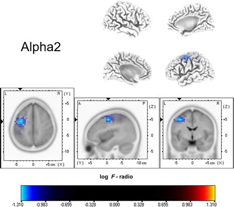 Frontiers Inhibition Of Brain Area And Functional Connectivity In