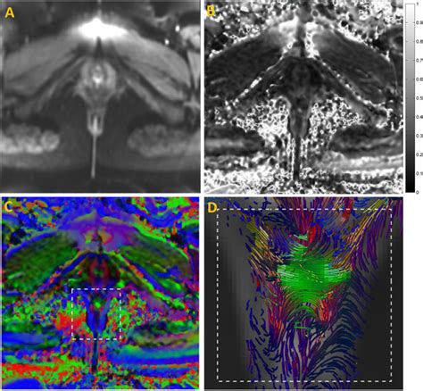 Connectivity Of The Superficial Muscles Of The Human Perineum A