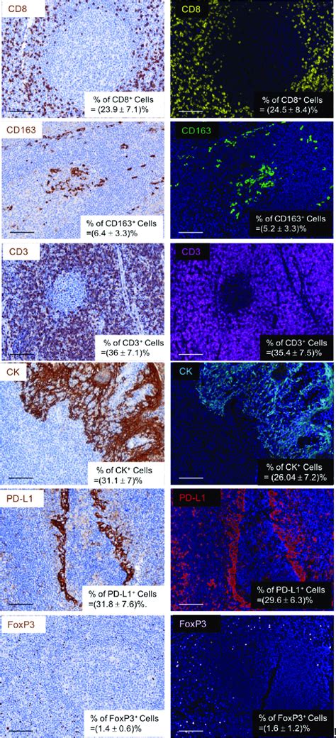Chromogenic Vs Opal Validation Of Singleplex Opal Fluorescent Stains