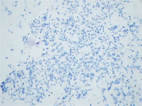 Pathology Outlines Accessory