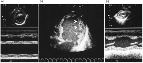 Echocardiographic Findings A M‐mode Echocardiography From A