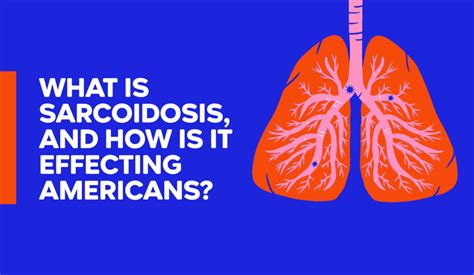 What Is Sarcoidosis And How Does It Effect Americans Direct Primary Care Of Boca Raton