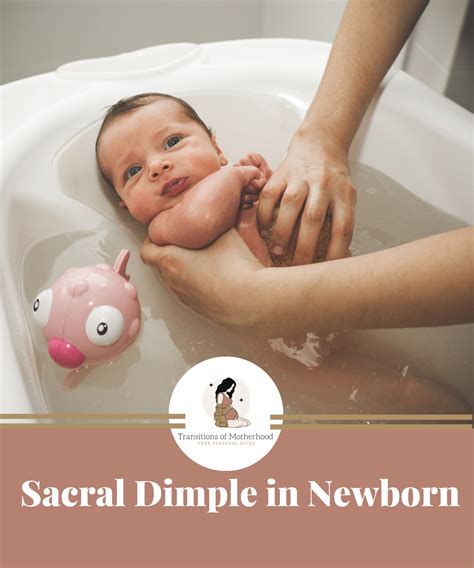 Sacral Dimple In Newborn Harmless Or Dangerous Tom