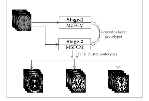 The Complete Work Flow Of The Proposed Two Stage 3d Image Segmentation Download Scientific