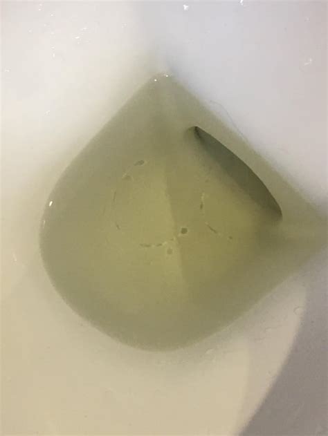 Can Anyone Identify These Worms Rparasitology