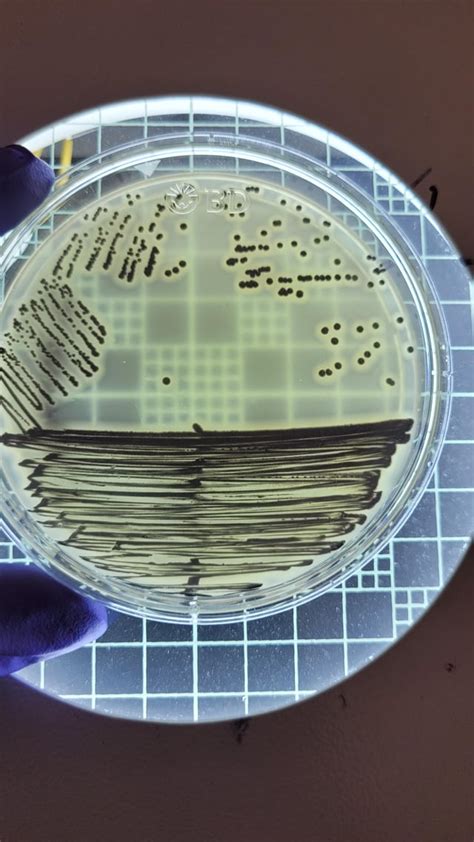 S Aureus Rmicrobiology