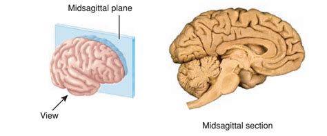 What Organs Are Not Visible In A Midsagittal Plane