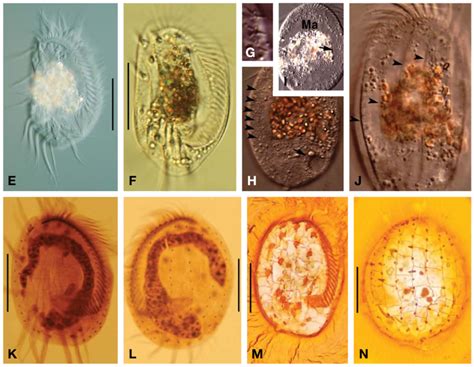 Morphology And Infraciliature Of Euplotes Minuta Yocom 1930 In Vivo