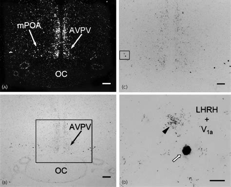 In Situ Hybridization Labeling At Cheryl Allison Blog