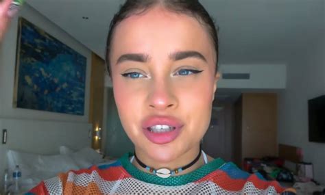 Fagata Wygląda Coraz Gorzej Po Tych Zdjęciach Pojawiła Się Masa Bardzo Złych Komentarzy Booppl