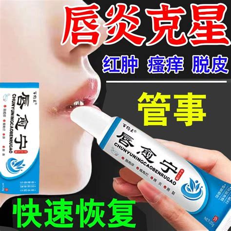 Cheilitis Irritation And Blistering In The Mouth Chapped Lips Chronic Cheilitis Mouth Sores