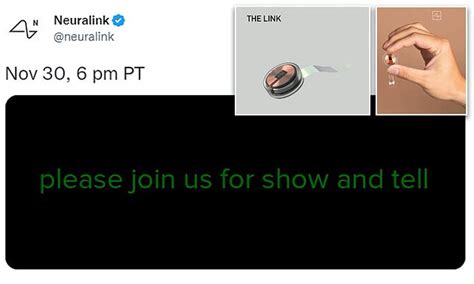 Elon Musk S Neuralink To Share Progress Of Its Brain Chip Tonight