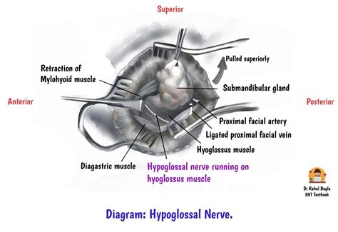 Submandibular Gland Surgery How To Protect Marginal Mandibular Nerve