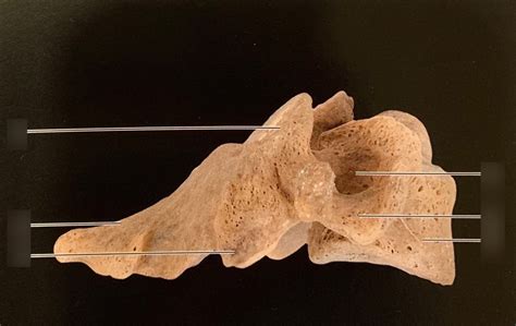 Cervical Vertebra C3 C7 Lateral View Diagram Quizlet