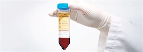 Sample Request Rosettesep