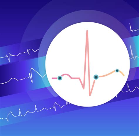 Clinical Ecg Interpretation The Cardiovascular