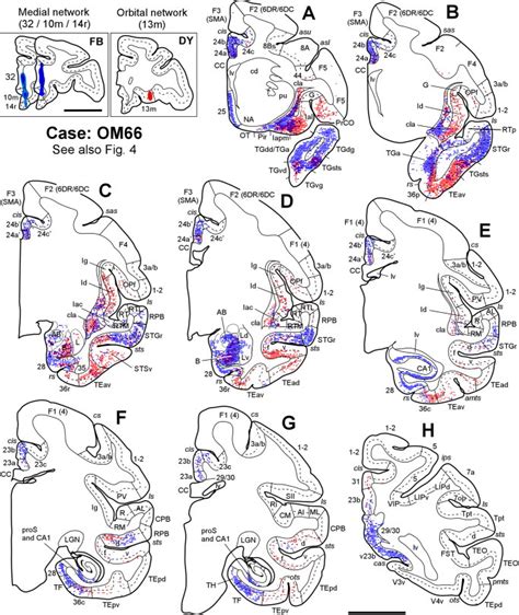 Ah Distribution Of Cells In The Temporal Cortex And Other Areas That