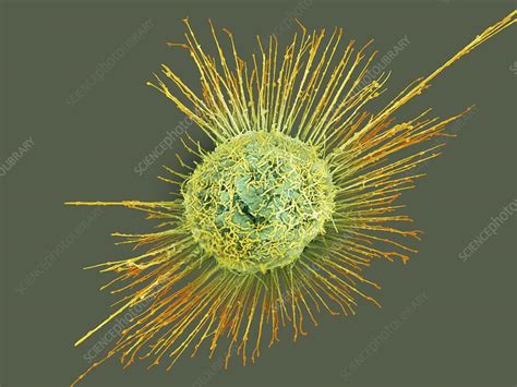 Lung Cell Infected With H1n1 Flu Virus Sem Stock Image C0386864