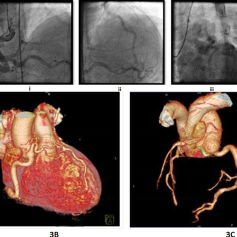 A −m Mode Of Lv Showing Moderate Lv Systolic Dysfunction Ef 40 B − Download Scientific