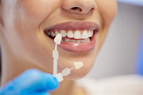 Veneers Vs Dental Bonding Which Option Is Right For Your Smile 3d