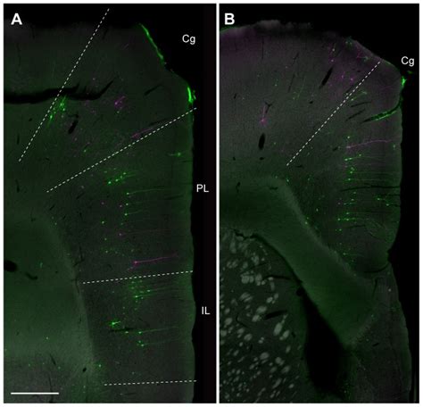 A Rostral Section Showing Labeling In The Prelimbic Pl The