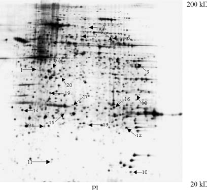 Effect Of Differential Protein Expression In 2 DE Differential Protein Download Scientific