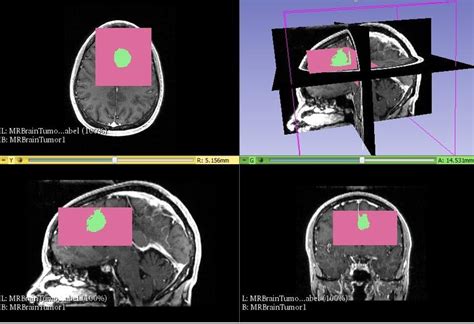 Grow Cut Effect And Selection Of Roi Download Scientific Diagram