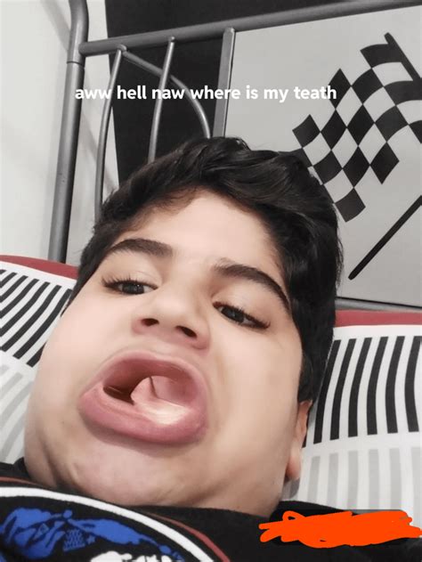 Where Is My Teath R Meme Making