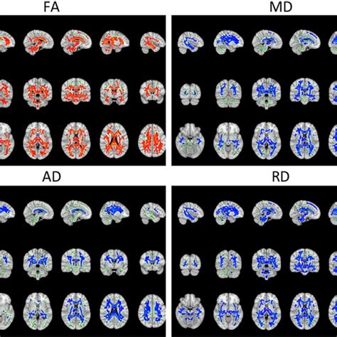 Tract Based Spatial Statistics Nonparametric Permutation Inference