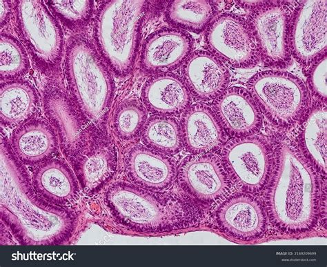 Labeled Epididymis Microscope Slide