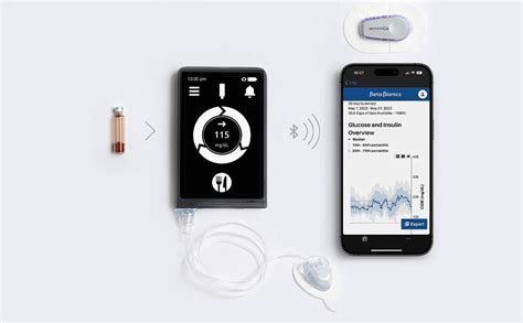 Bionic Pancreas Approved By Fda Diabetes Australia